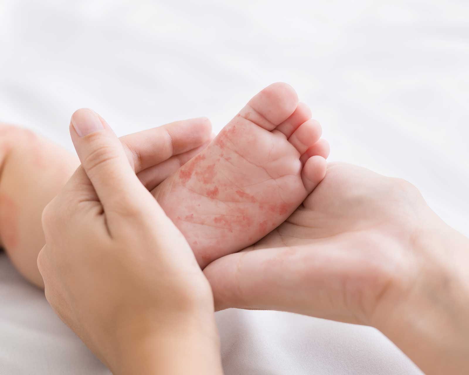 Protect Your Family: Understanding the MMR Vaccine - Sundon Medical Centre